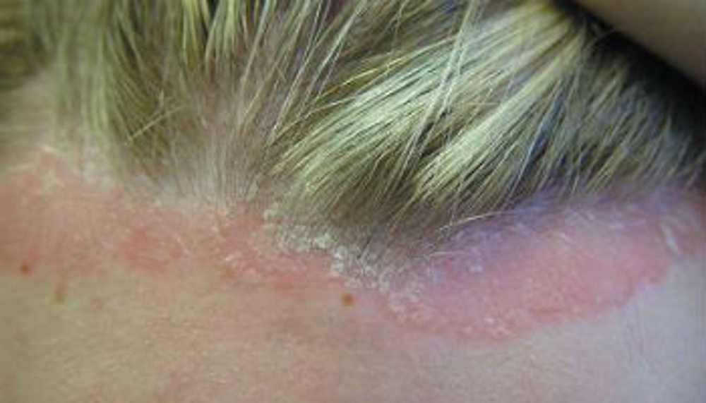 Chcete mít krásné vlasy a zdravou pokožku hlavy i v zimě? - THERMELOVE